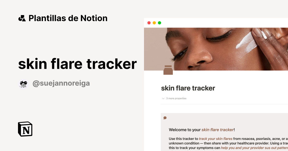 Plantilla skin flare tracker de Sue-Jan Noreiga | Notion Marketplace