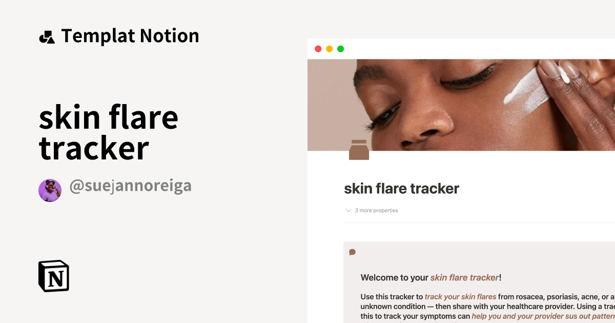 skin flare tracker Templat oleh Sue-Jan Noreiga | Notion Marketplace