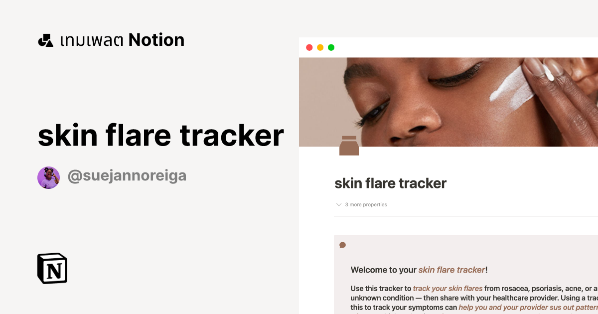 เทมเพลต skin flare tracker โดย Sue-Jan Noreiga | มาร์เก็ตเพลส Notion